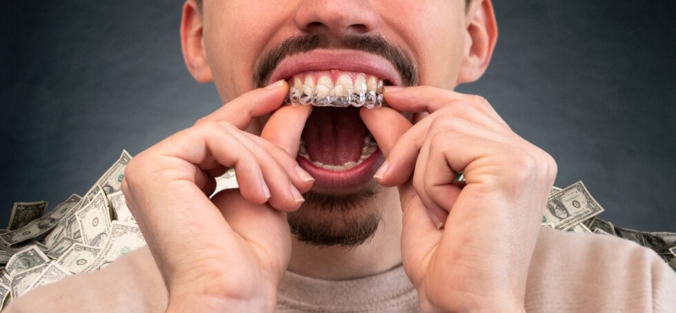 How Much Is Invisalign: Ultimate Treatment Costs Guide 2024