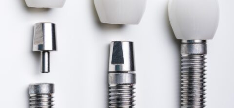 How to Clean All on 4 Dental Implants | Ultimate Care Guide