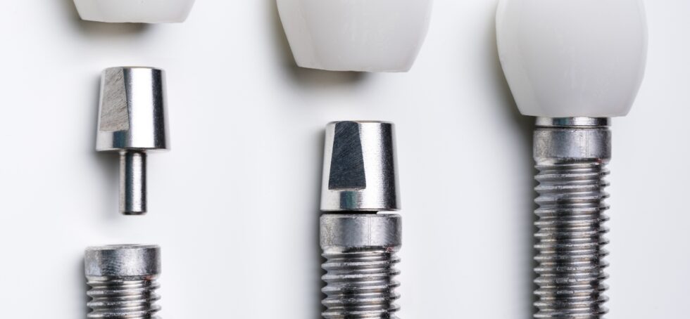 How to Clean All on 4 Dental Implants | Ultimate Care Guide