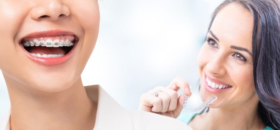 How Does Invisalign Work: A Clear Guide to Straightening