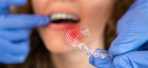 How Long Does Invisalign Hurt: The Truth Behind Discomfort