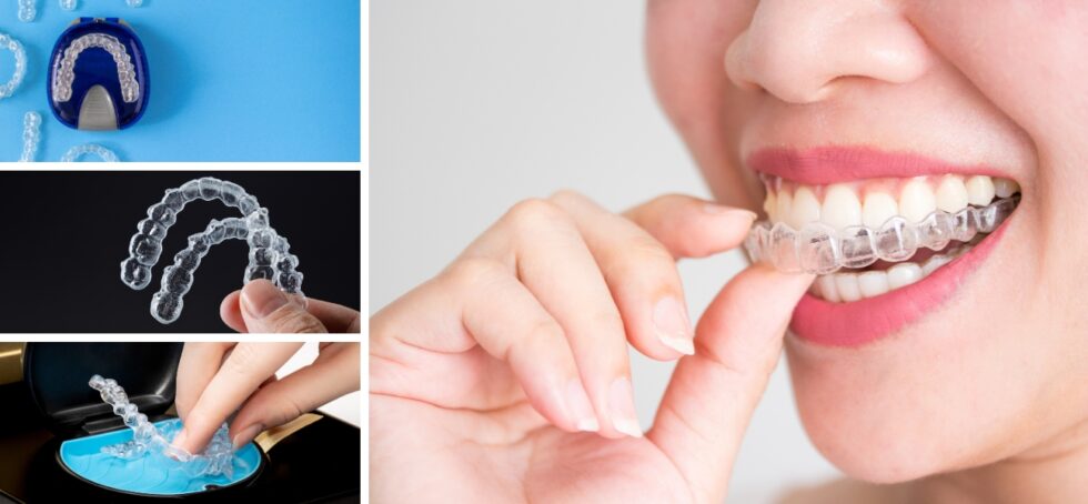 What Do Invisalign Retainers Look Like: Advice and Care Tips