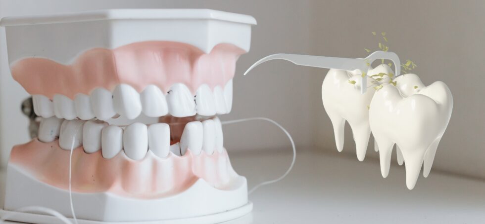 How to Floss All on 4 Dental Implants: Easy to Follow Guide